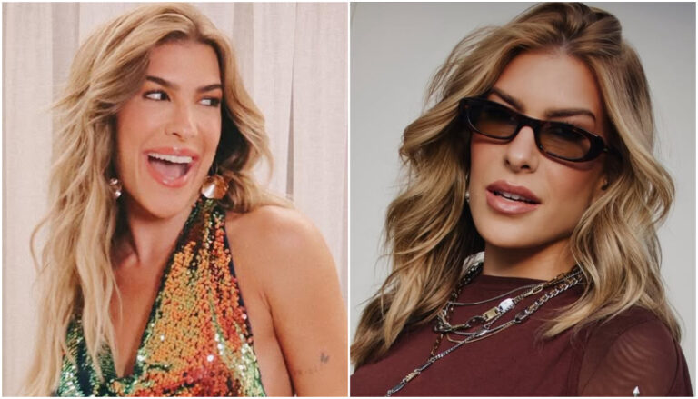 Lore Improta exibe resultado de tratamento pra entrada e fios ralos - Mulher